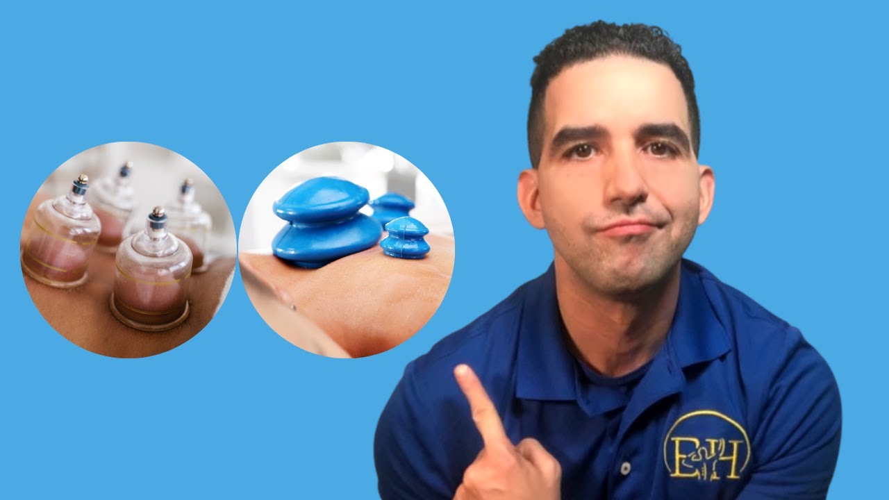 Cupping in Massage Therapy: The History, Techniques, and Benefits of ...