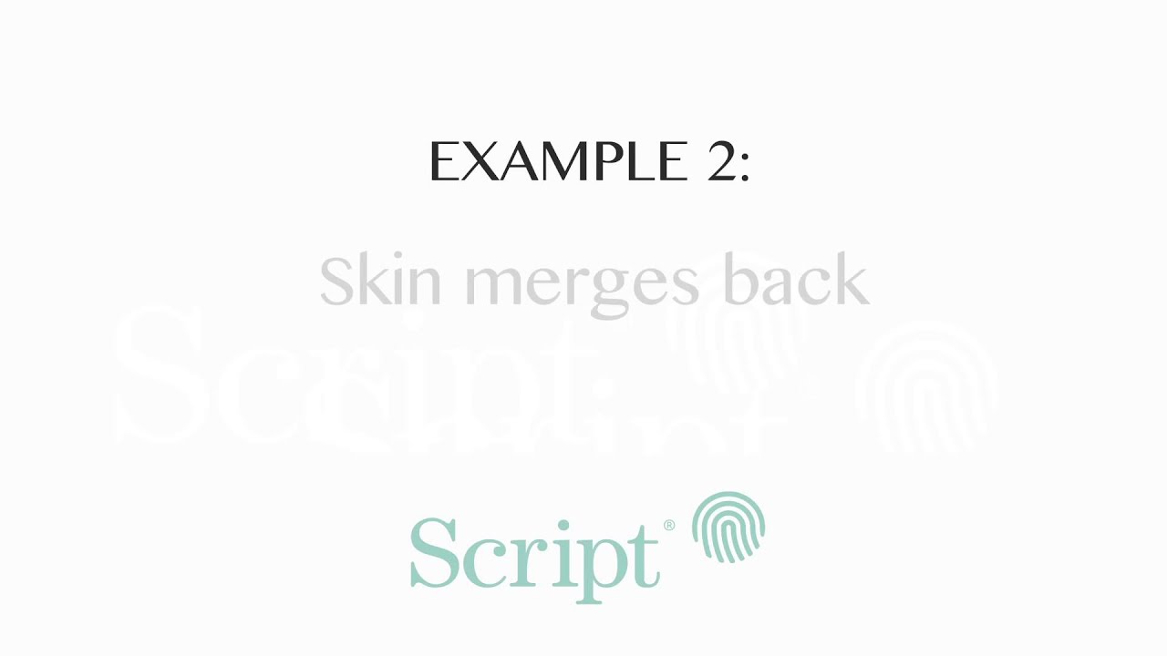 How to conduct a skin elasticity test - YouTube