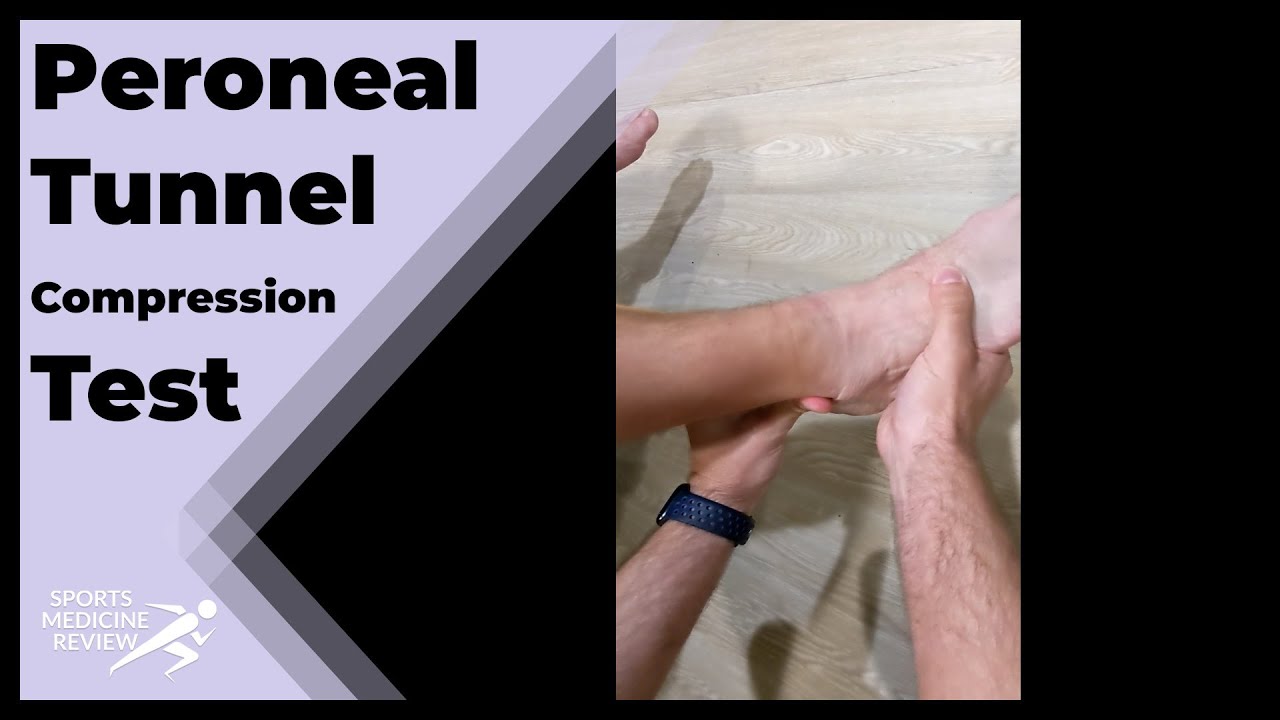 Peroneal Tunnel Compression Test (for Peroneal Tendonitis) - YouTube