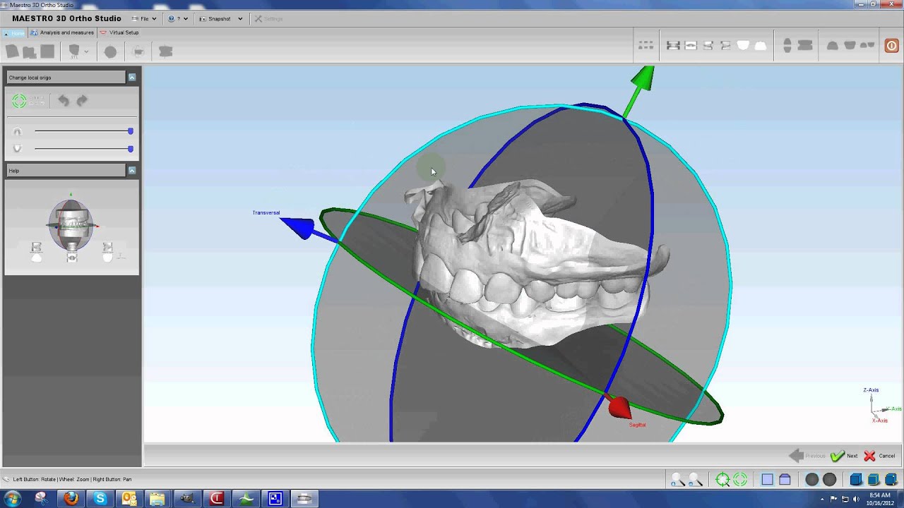 Ortho Studio - Part 5. Adding work model base to a scan.avi - YouTube