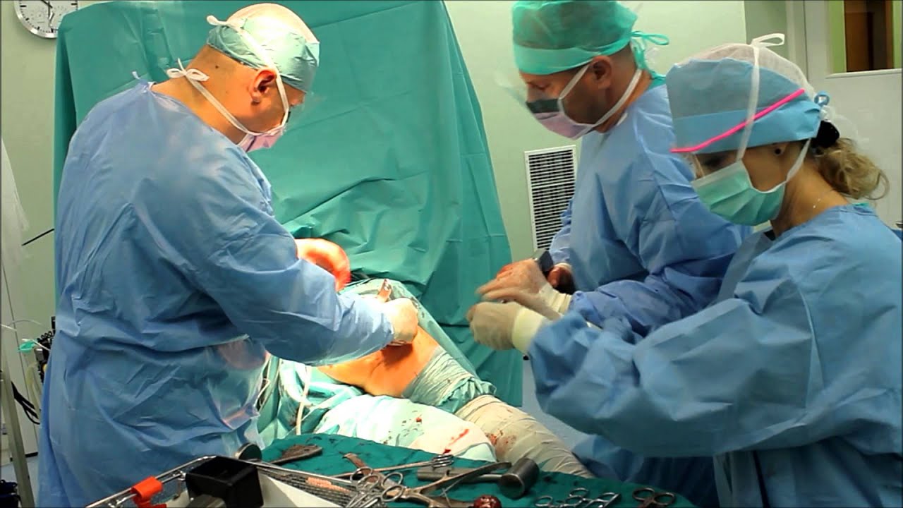 Ortopedzi. Szpital Powiatowy im. JP II w Bartoszycach - YouTube