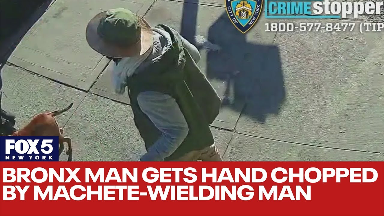 Bronx man gets hand chopped by machete-wielding man - YouTube