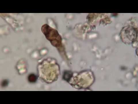 Looking at Soil Microbes with a Compound Microscope. - YouTube