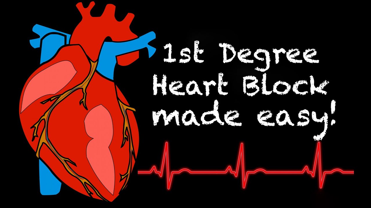 EMS Cardiology || Tachy Tuesday: 1st Degree Heart Block in EMS - YouTube