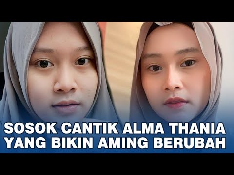SOSOK Alma Thania, Artis Cantik yang Bikin Aming Berubah, 'Kami Saling ...