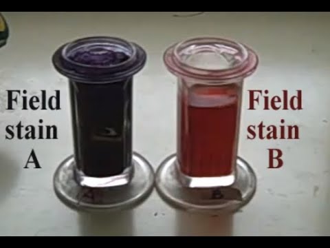 #cbc|#field stain "A" AND "B"|#pheripheral BLOOD SMEAR. - YouTube