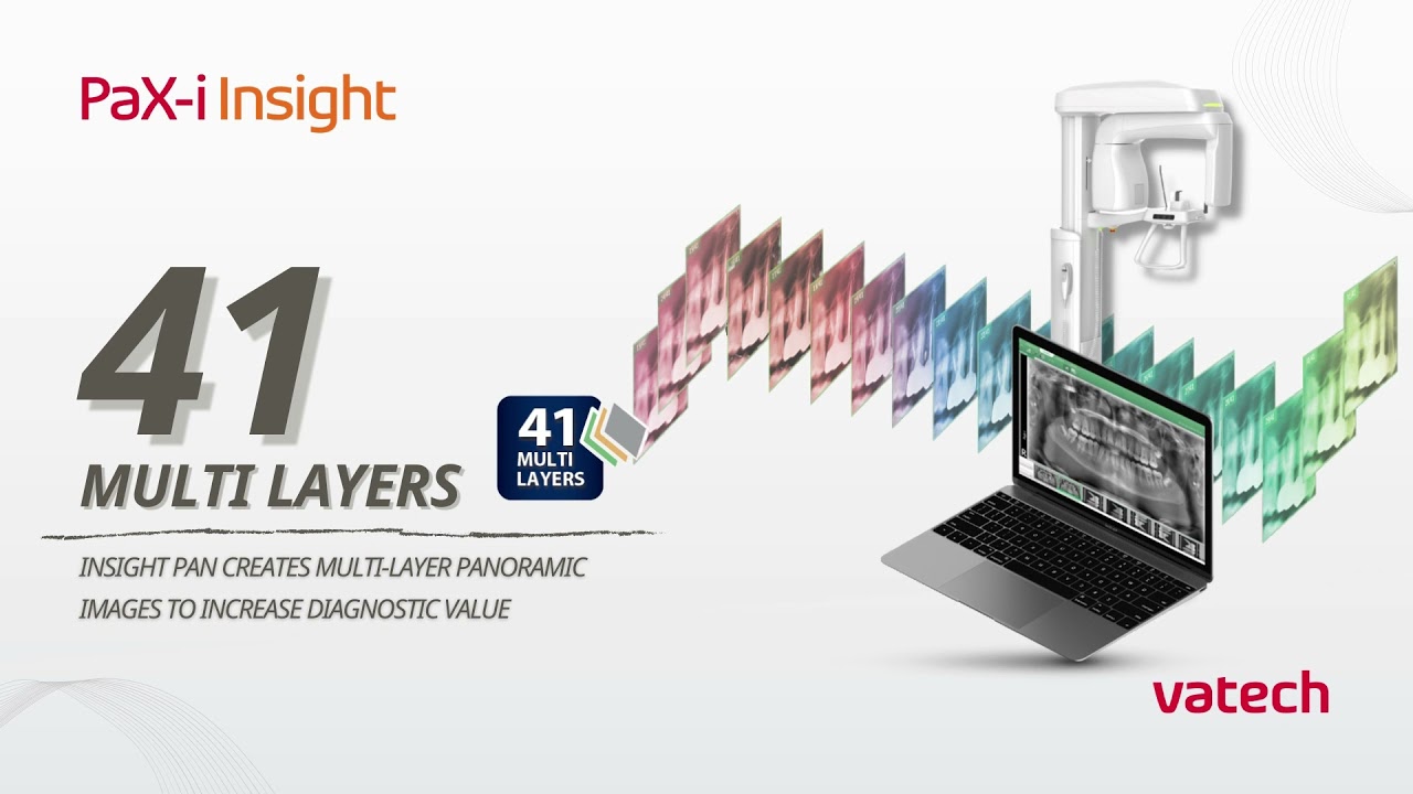 PaX i Insight - YouTube