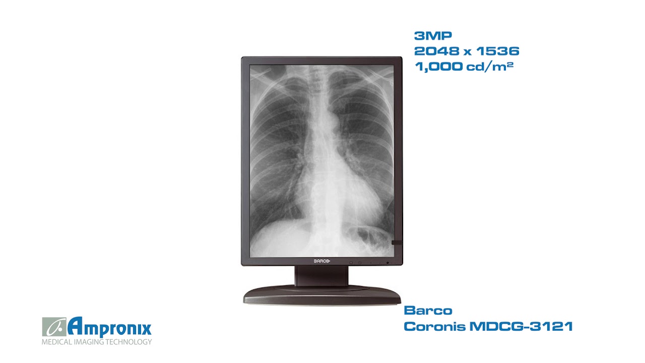 Barco Coronis MDCG-3121-CB Display Monitor Screen Sales | Service ...