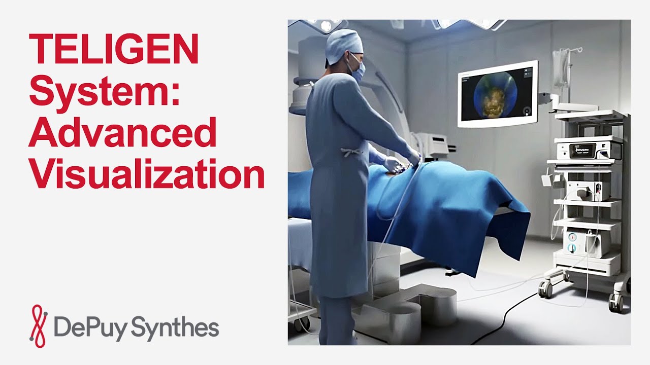 TELIGEN System Overview: Visualization and Control in Spine Surgery | J ...