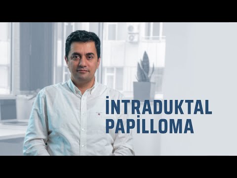 Süd vəzinin xoşxassəli törəmələri - intraduktal papilloma