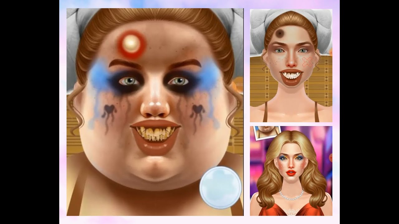 ASMR Fat Girl Transformation | Big Pimple Popping Animation | TRendy ...