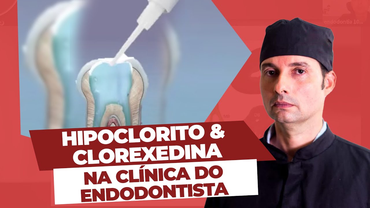 Como usar o Hipoclorito e Clorexedina em Endodontia - YouTube