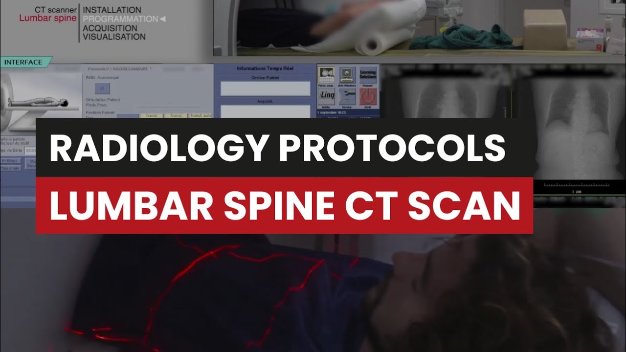 Lumbar Spine CT: Protocol Guide for Computed Tomography Techs - YouTube
