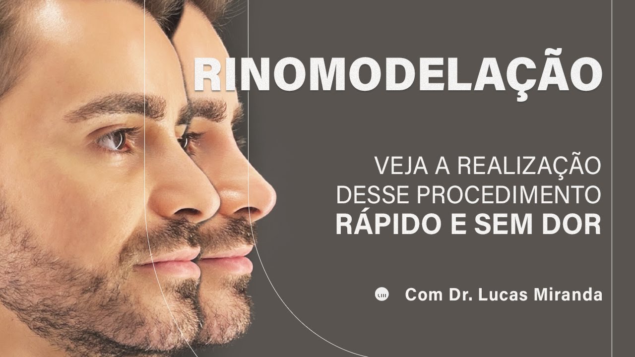 Veja o antes e depois de um procedimento de Rinomodelação (Dr. Lucas ...