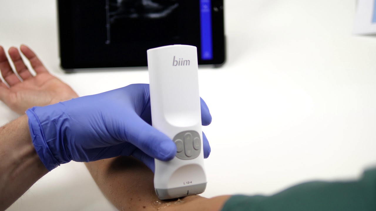 Biim Ultrasound - Teaser - YouTube