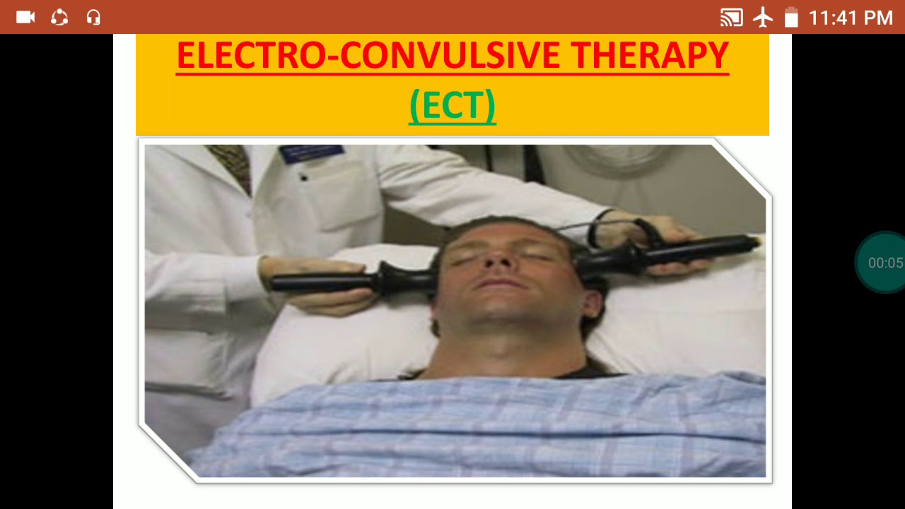 Electro convulsive therapy(ECT):Physical therapy in psychiatry ...