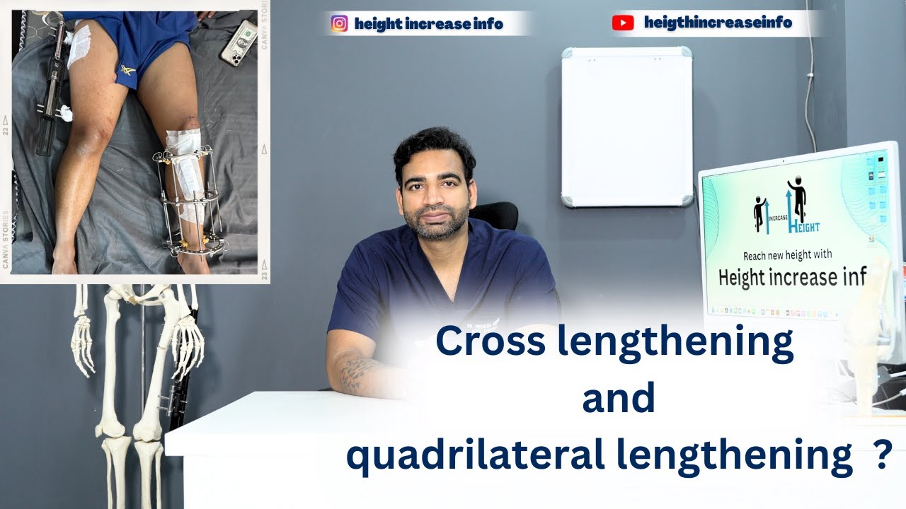 Cross lengthening and quadrilateral lengthening ? # ...