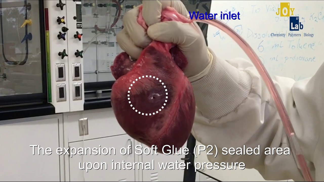 Sealing Heart Puncture Using Biodegradable Tissue Adhesive in Blood ...