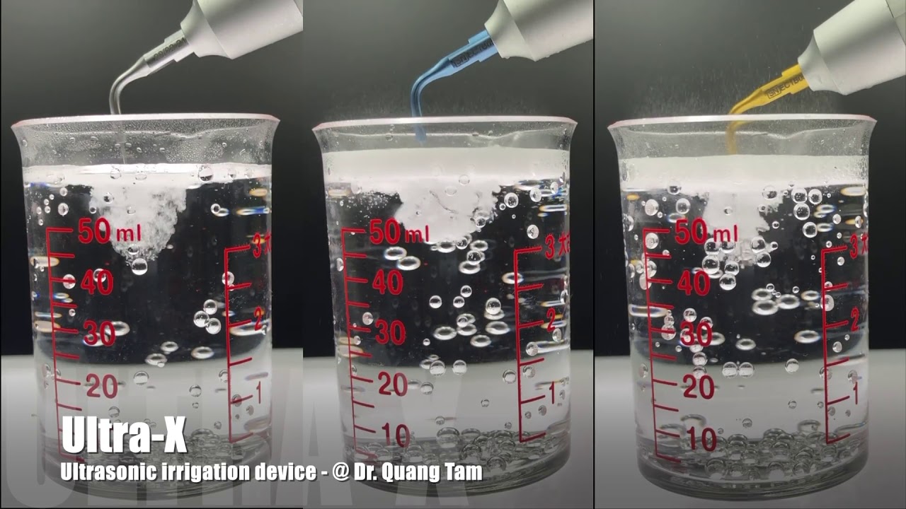 Effect of Ultra X's Tips - By Dr.Quang Tam Eighteeth Ultrasonic ...