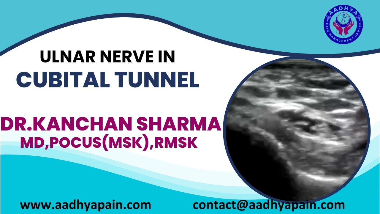 Ultrasound of the Ulnar Nerve in the Cubital Tunnel and its Dynamic ...