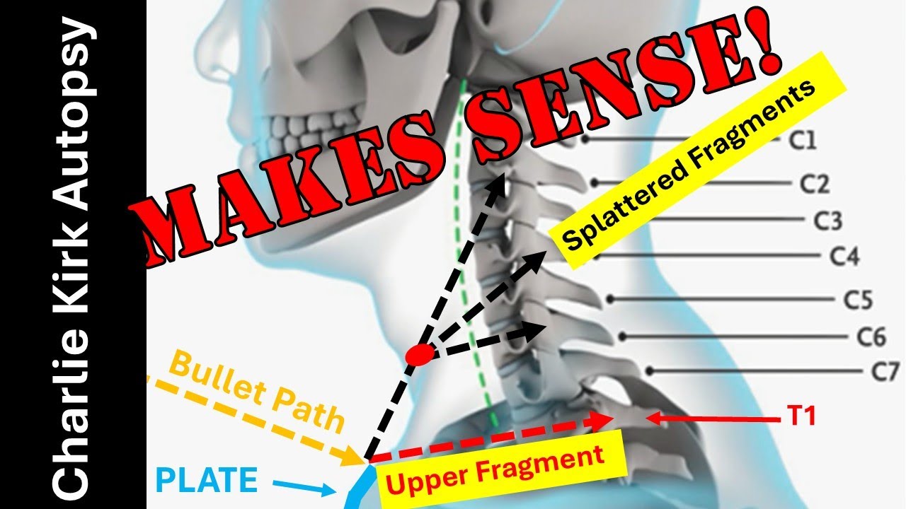 Charlie Kirk Autopsy: Make Sense? - YouTube