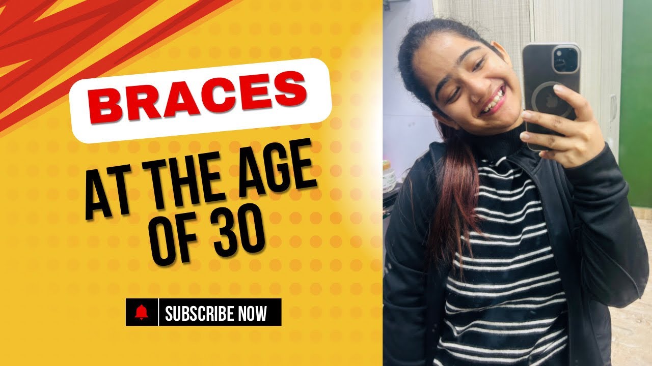 “Getting Braces at 30: My Journey to a Perfect Smile” - YouTube