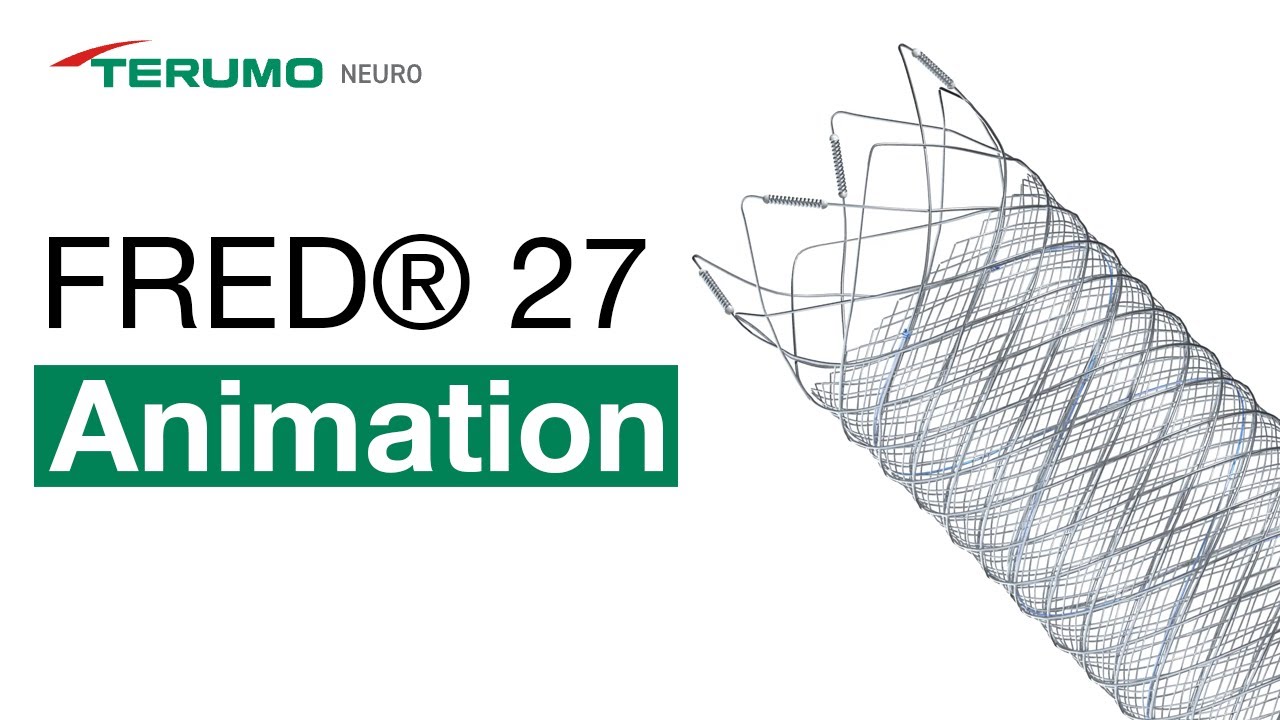 FRED™ 27 System Animation - YouTube