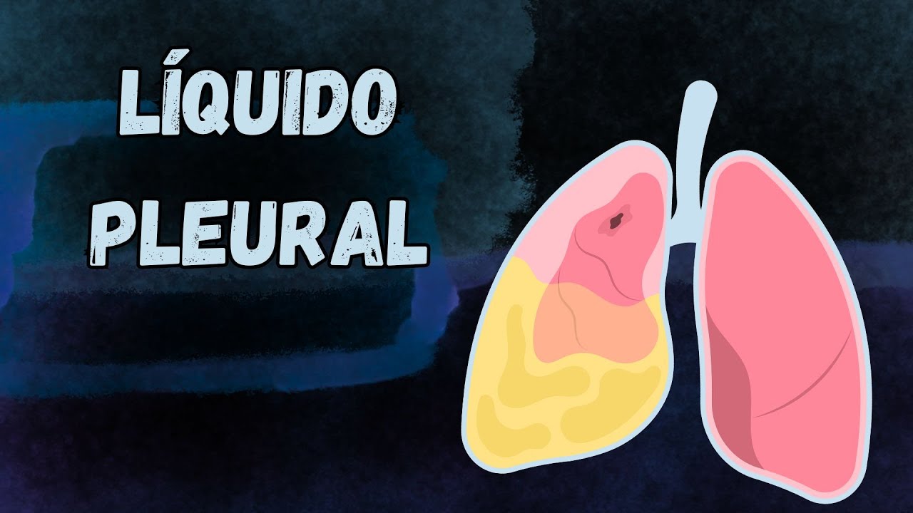 Líquido pleural. Células mesoteliales - YouTube
