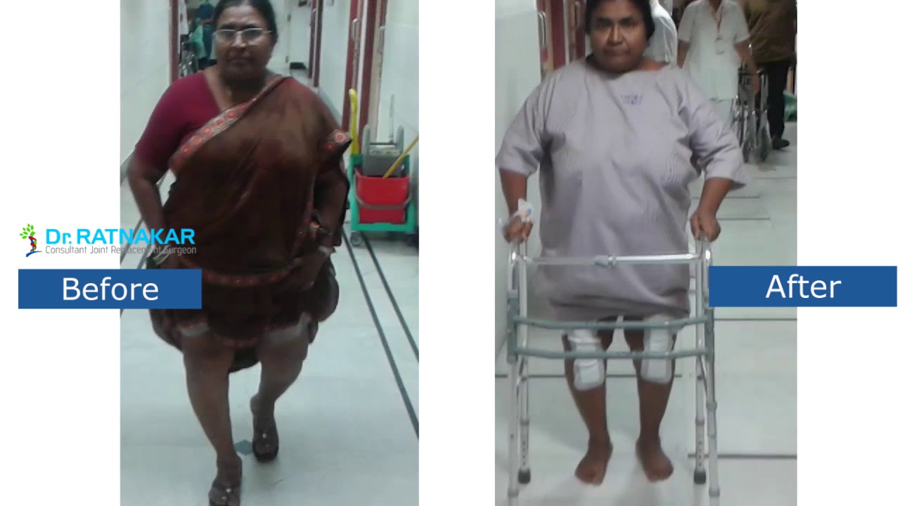 Mary Patient Testimonial for Dr Ratnakar Rao - YouTube