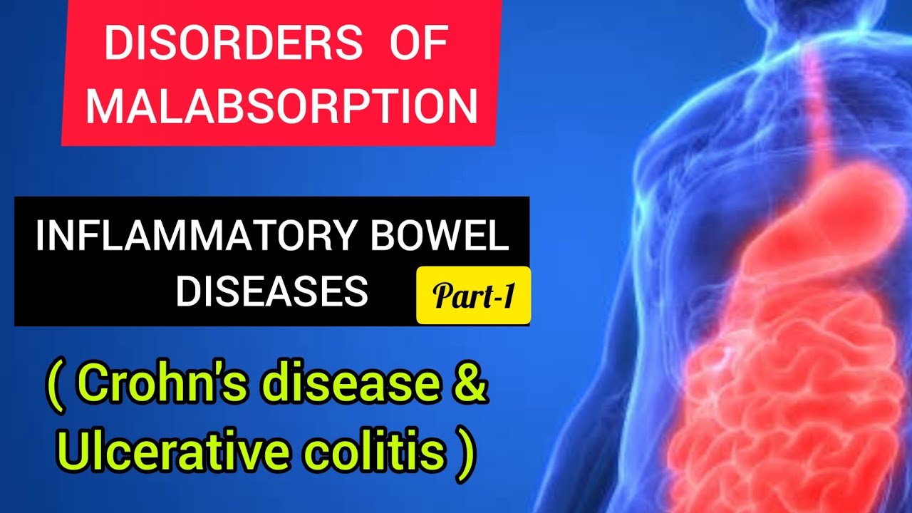 INFLAMMATORY BOWEL DISEASE (CROHN'S DISEASE & ULCERATIVE COLITIS) PART ...