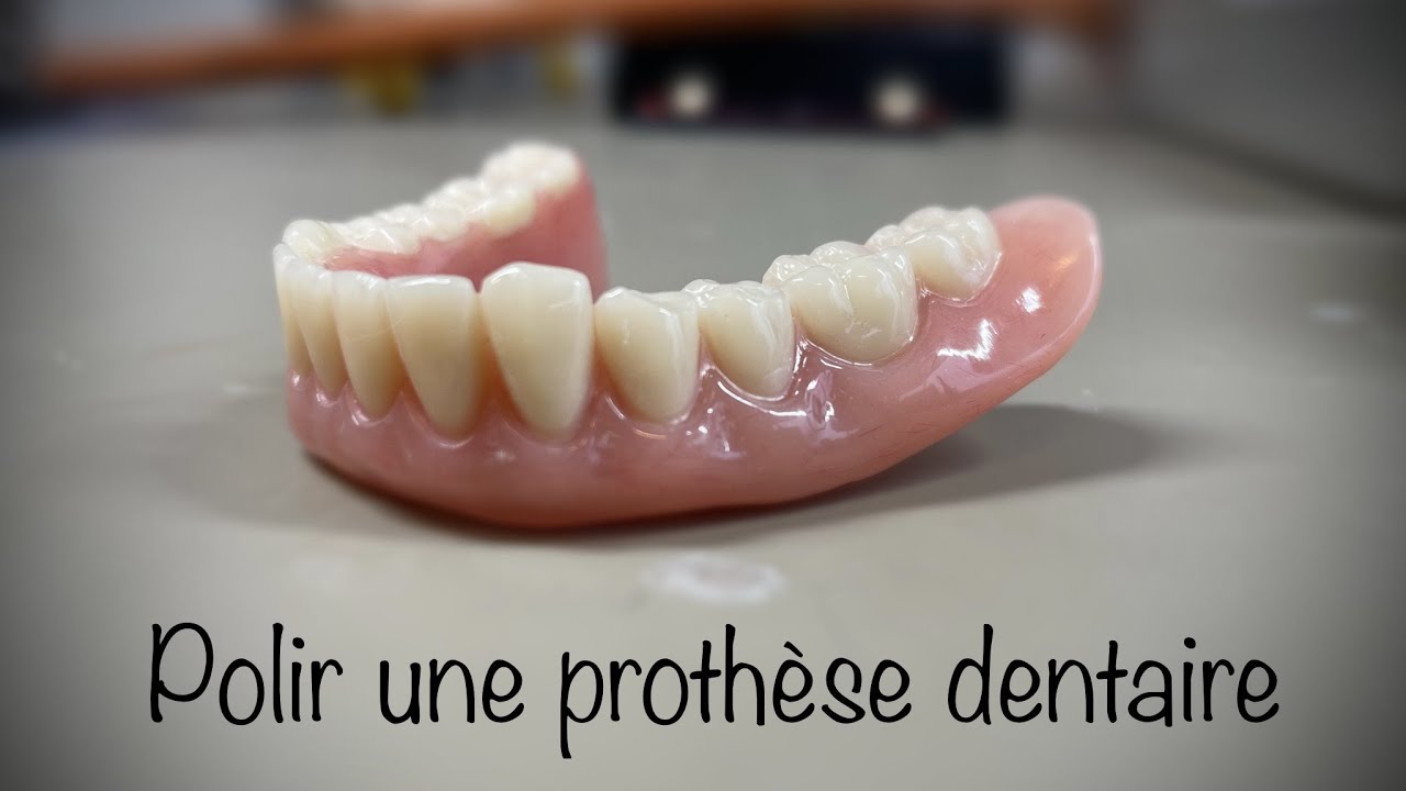 Prothèse dentaire supérieure et inférieure ( finition 'd'une prothèse ...