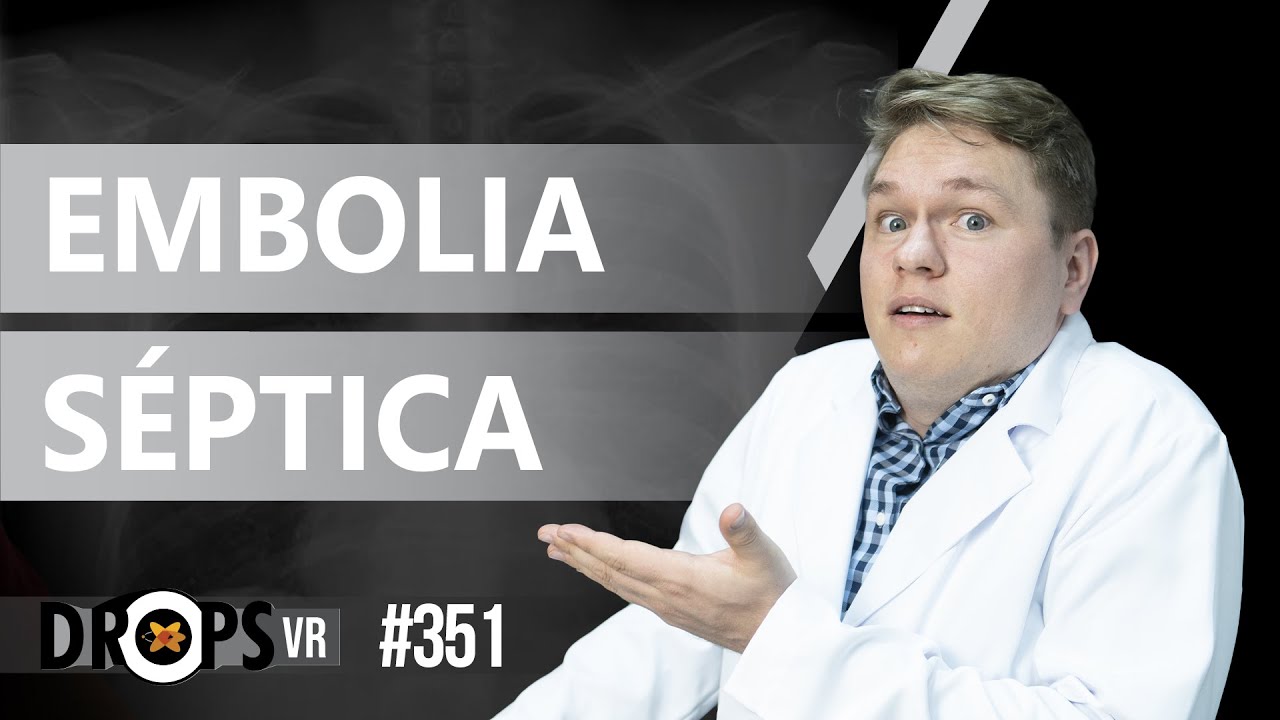 EMBOLIA SÉPTICA - YouTube