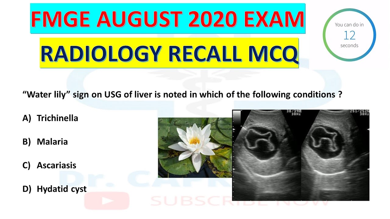RADIOLOGY FMGE AUG 2020 EXAM | FMGE AUGUST RECALL MCQ | Image Based ...