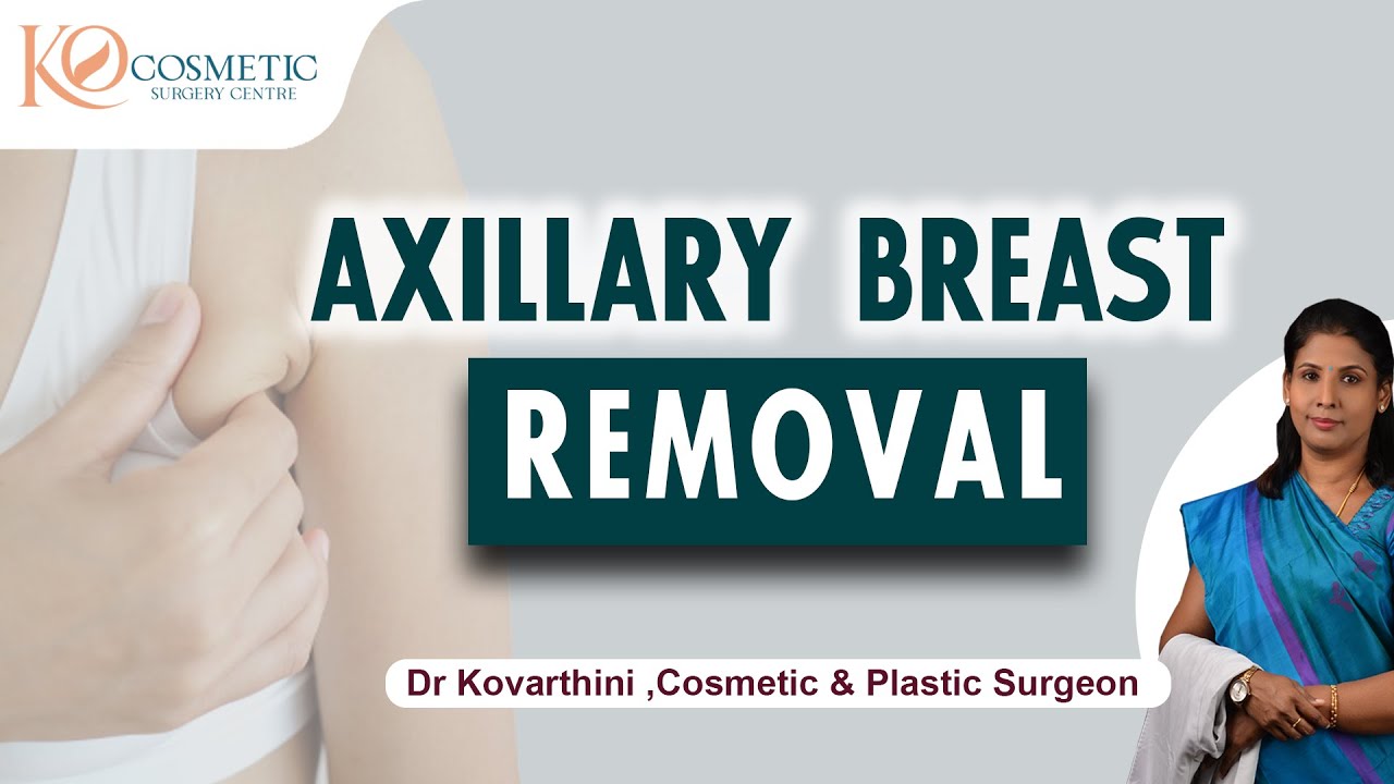 Axillary breast removal | Ko Cosmetic Surgery Centre | Dr. Kovarthini ...