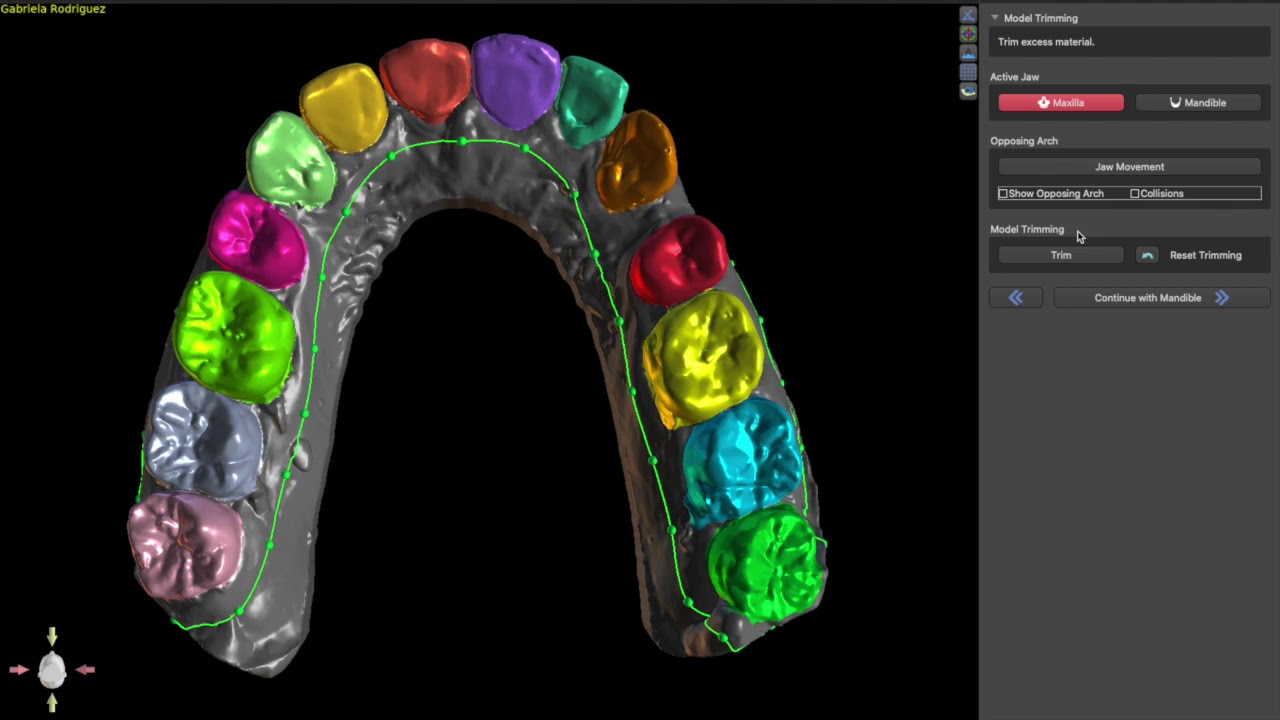 LO NUEVO EN BlueSkyBio Ortho 4 7 - YouTube