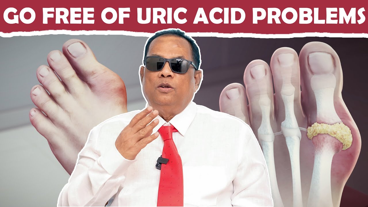 (English)Go Free of Uric Acid Problem / Dr.C.K.Nandagopalan - YouTube