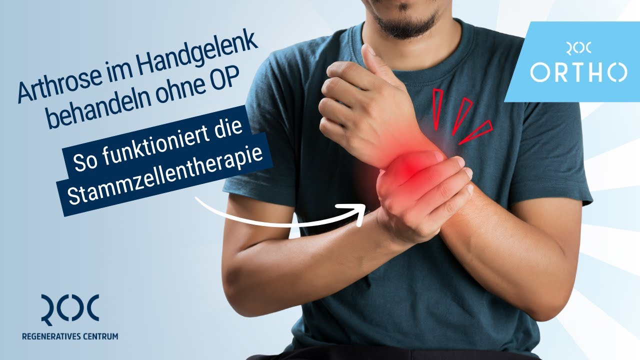 Arthrose im Handgelenk behandeln ohne OP - Stammzellentherapie im ROC ...