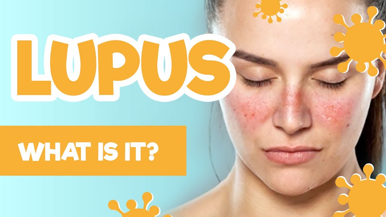 What is Lupus? #lupus #lupusawareness - YouTube