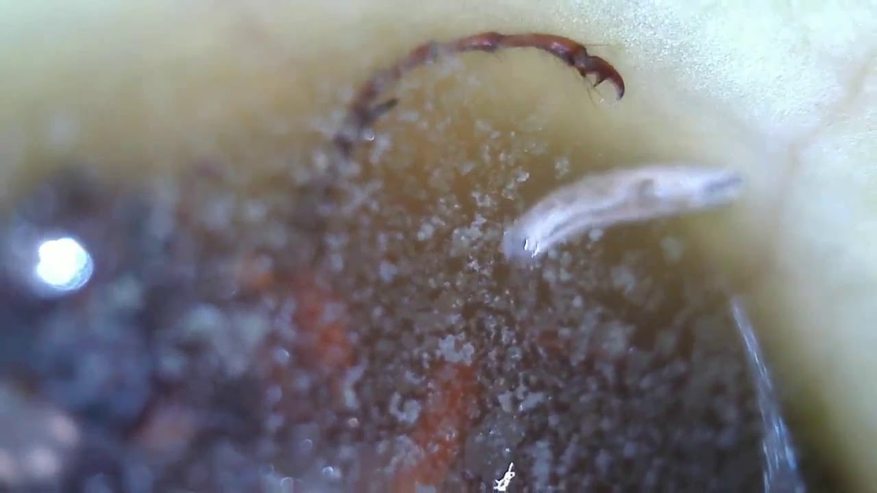 Flesh Fly Larva in Sarracenia Yellow Jacket 20190914 182141 - YouTube