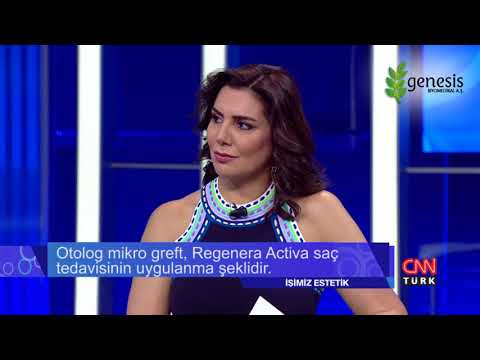 Dr. Tayfun Oğuzoğlu Saç Tedavisinde Otolog Mikrogreft yöntemini anlatıyor.