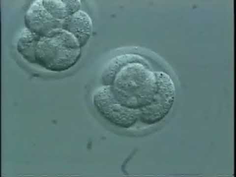 Honolulu Method - YouTube