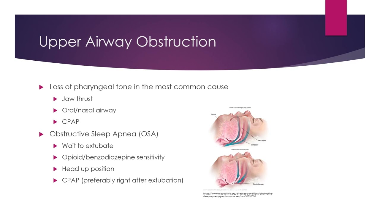 Post-Anesthesia Recovery - (Dr. Fain) - YouTube