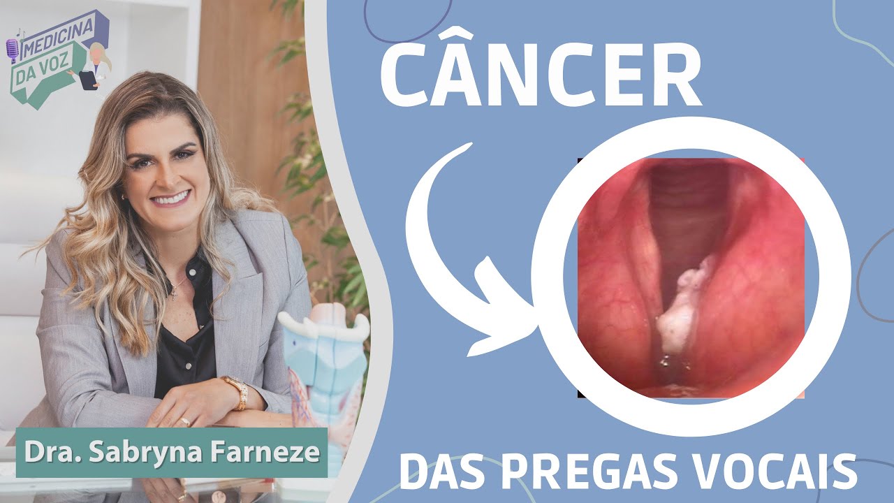 Câncer de Laringe: Sintomas e causas - YouTube