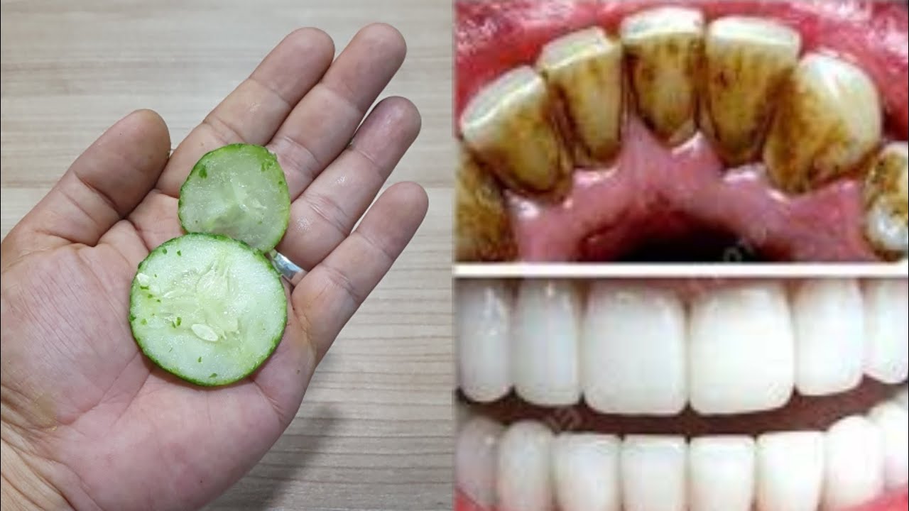 This method will make dirty yellow teeth white - YouTube