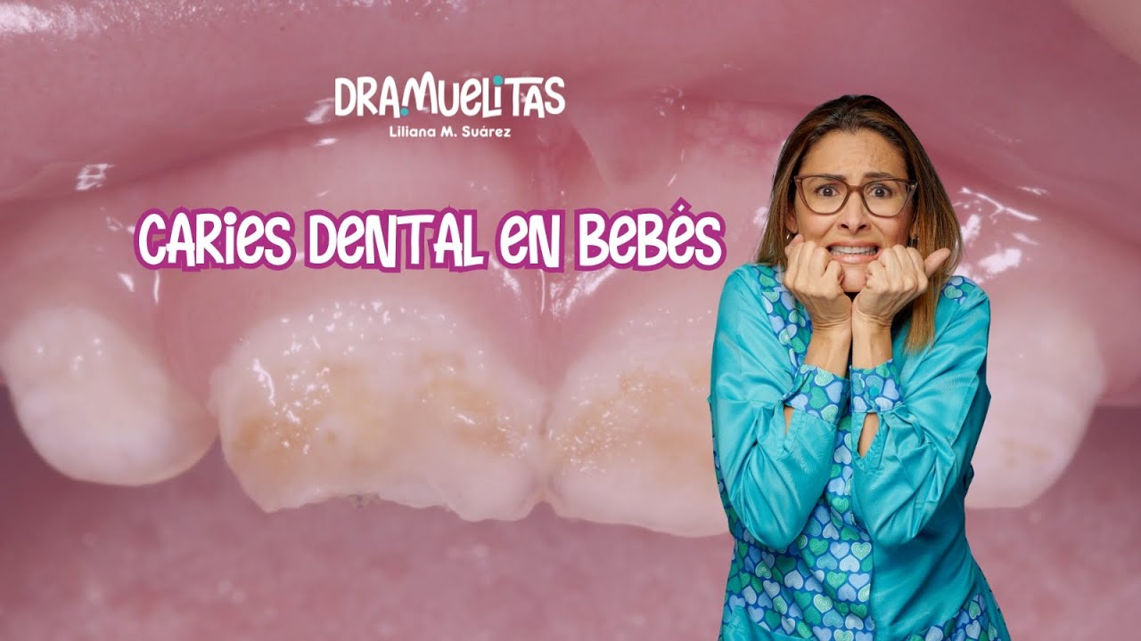 CARIES DENTAL EN BEBÉS - YouTube