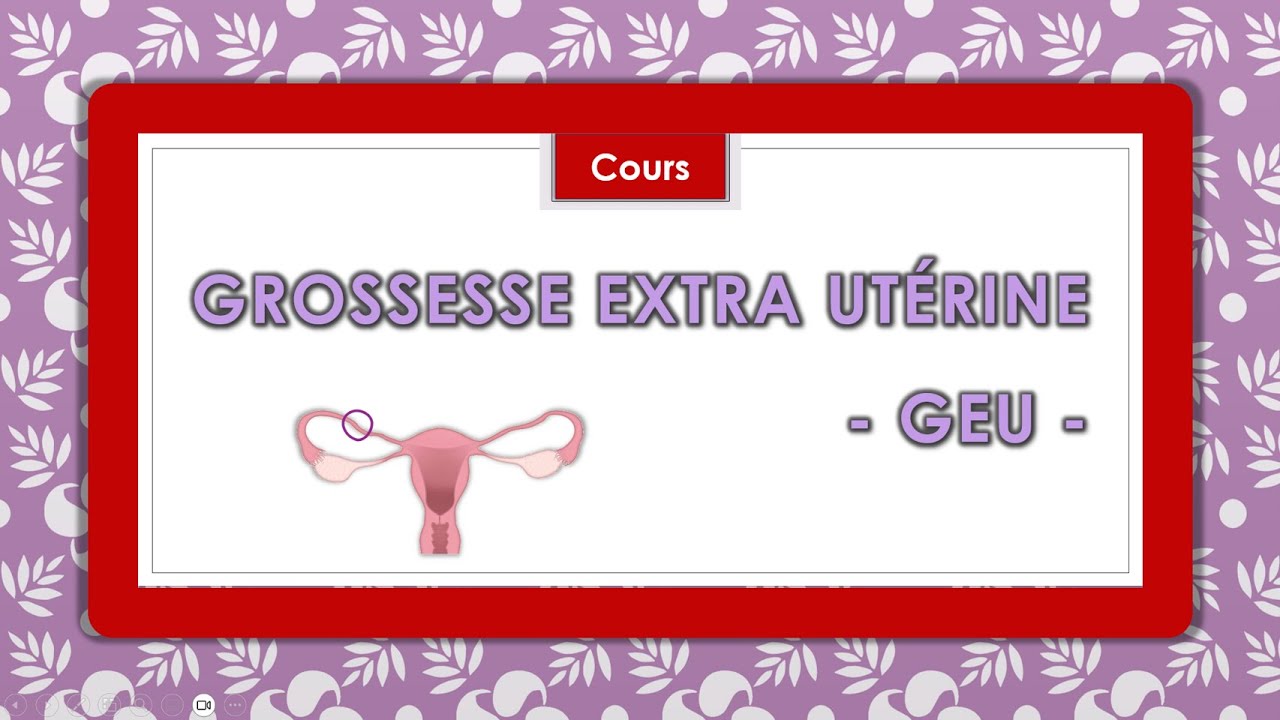Grossesse extra-utérine : 03 signes à repérer d’urgence 🤯 # ...