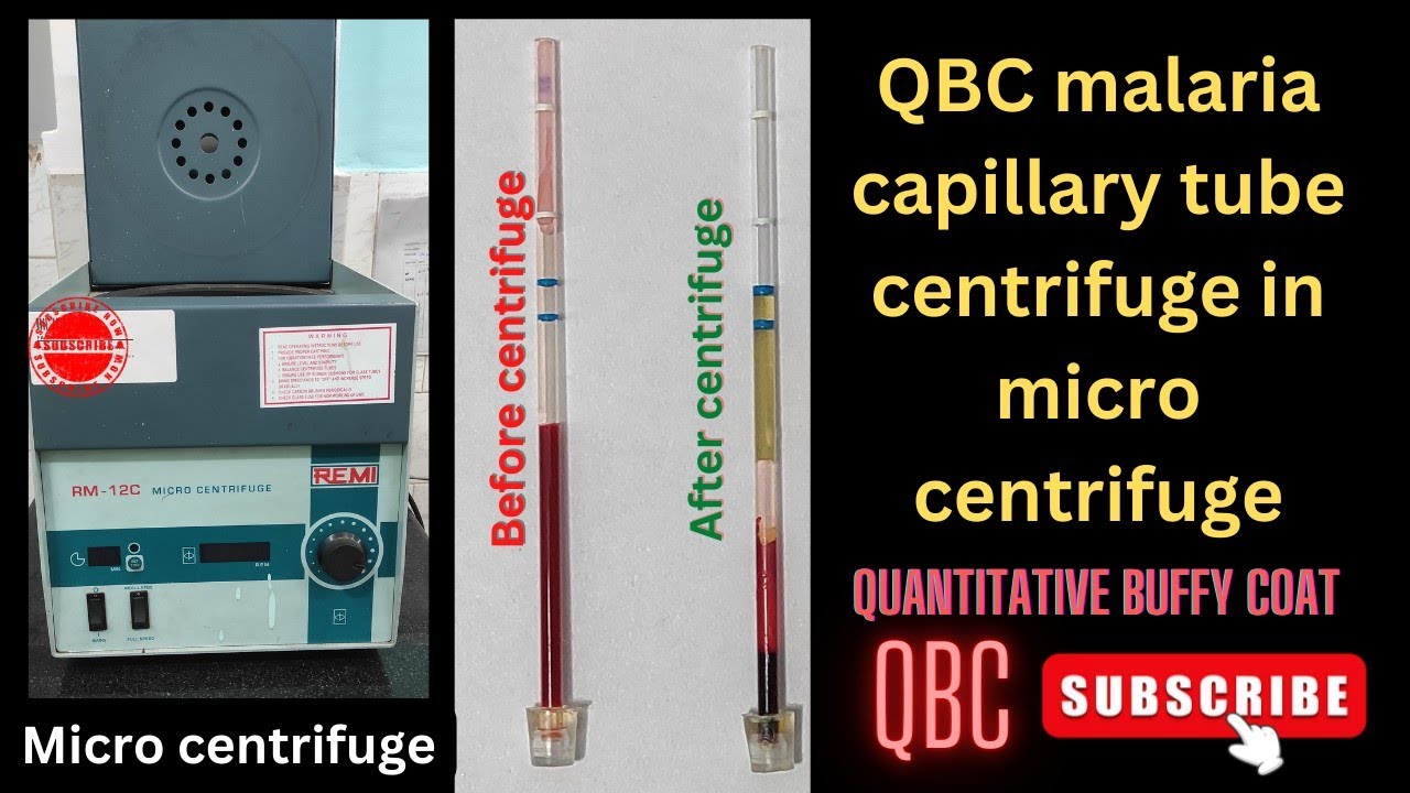 QBC malaria capillary tube centrifuge in micro centrifuge ...
