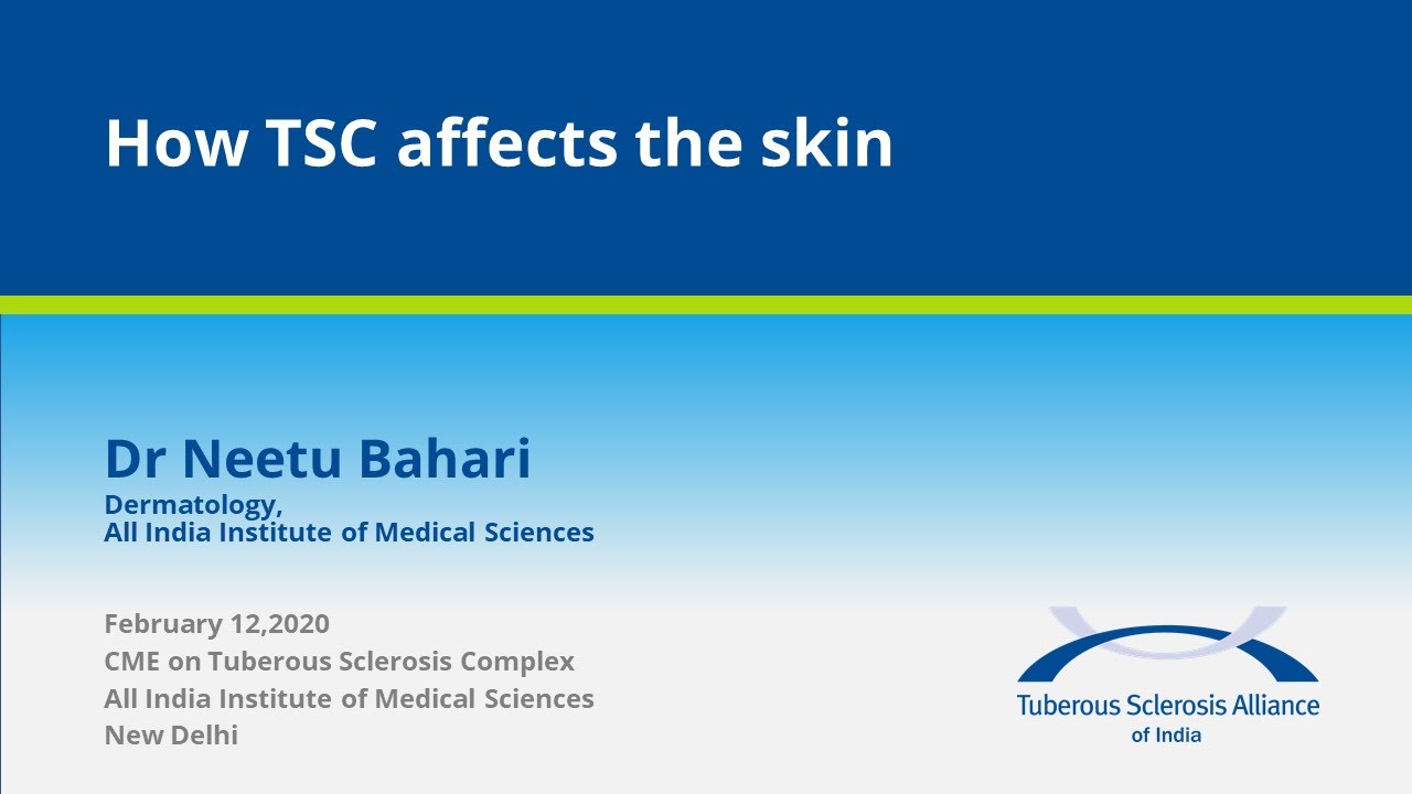 11 How TSC affects the skin - YouTube