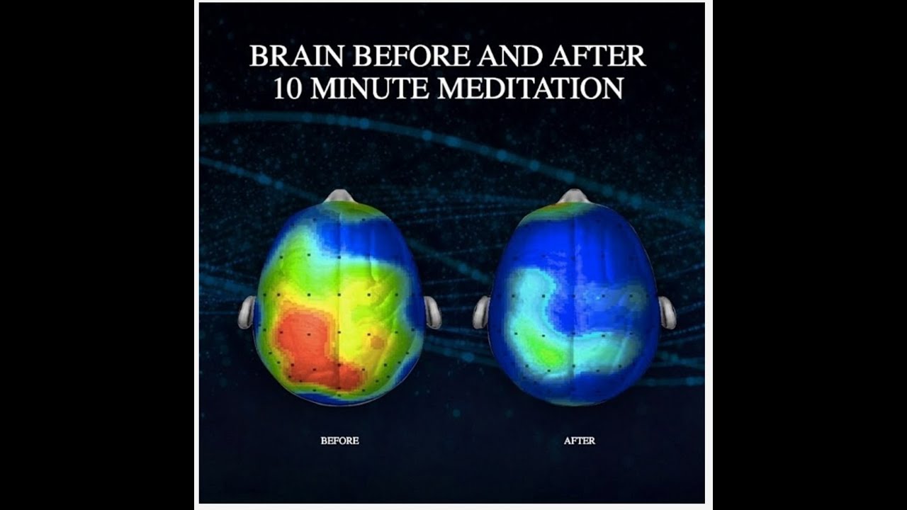 How Meditation Changes The Brain & Expands Our Consciousness - YouTube