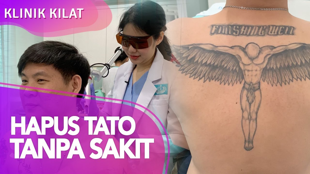 Hapus Tato, Tak Sesakit dan Seperih Kenangan Mantan - KLINIK KILAT ...